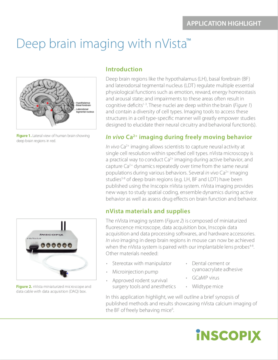 Deep brain imaging application highlight